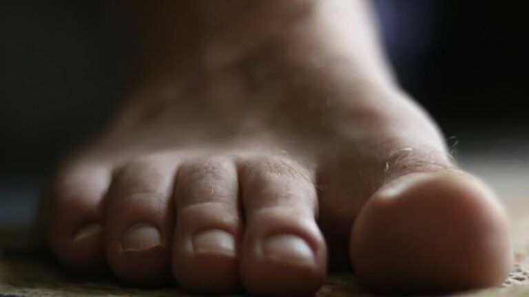 Athlete’s Foot vs Dry Skin: How to Tell the Difference and Treat It ...